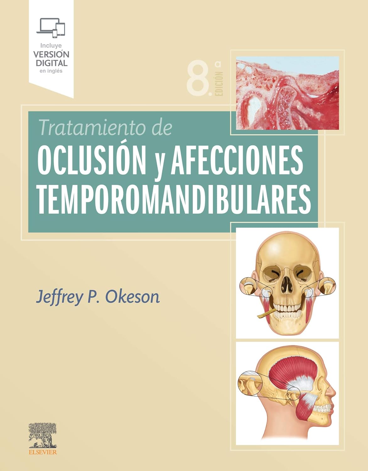 Tratamiento de oclusión y afecciones temporomandibulares eBook : Okeson ...