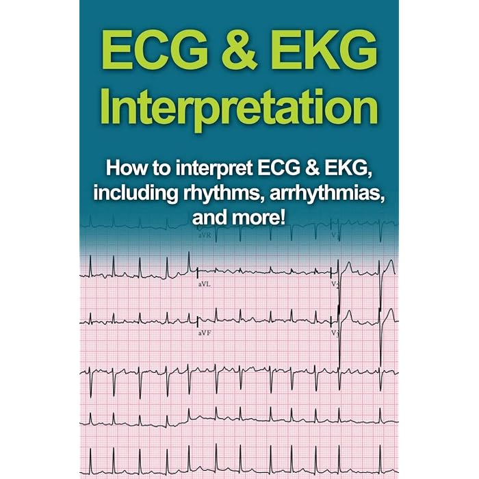 Buy ECG & EKG Interpretation: How to interpret ECG & EKG, including ...