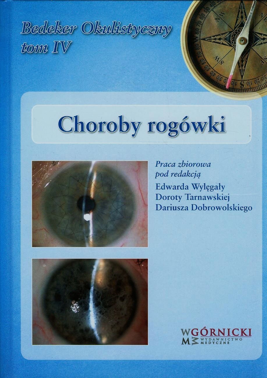 Choroby rogowki Tom 4 (Polish Edition): unknown author: 9788361257981 ...