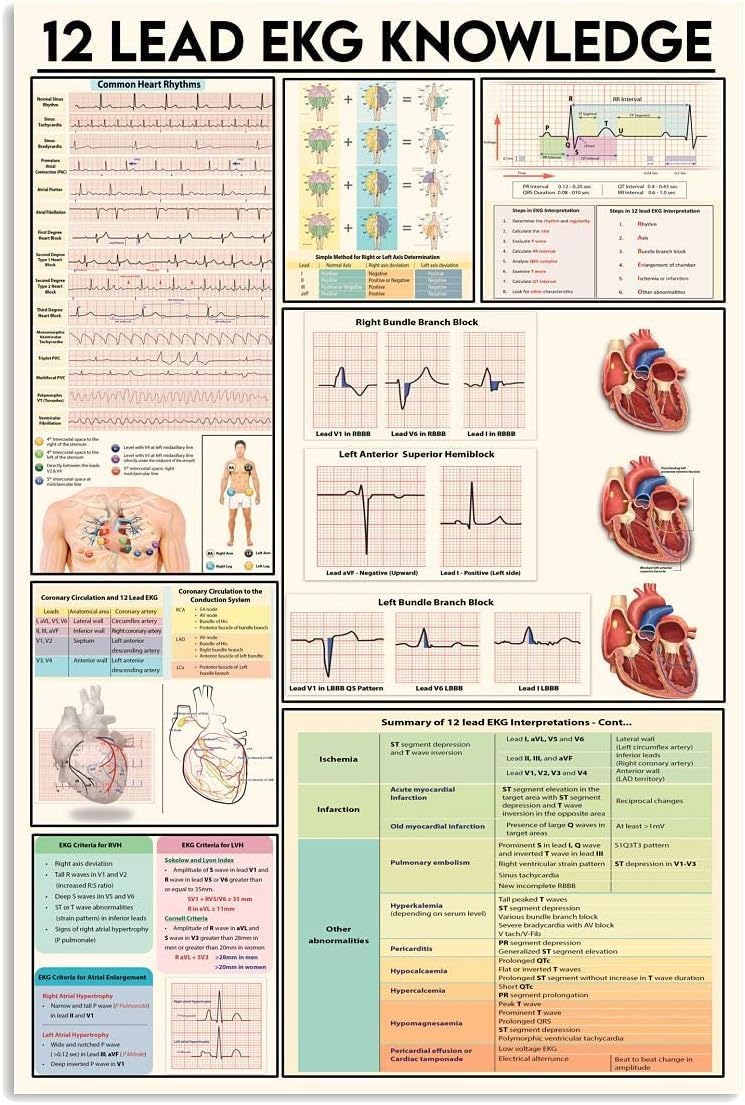 Amazon.com: 12 Read Ekg Knowledge Metal Signs Office Decor Doctor ...