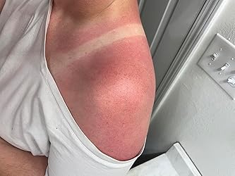 Amazon.com : Solar Recover After Sun Moisturizing Spray (12 Ounce ...