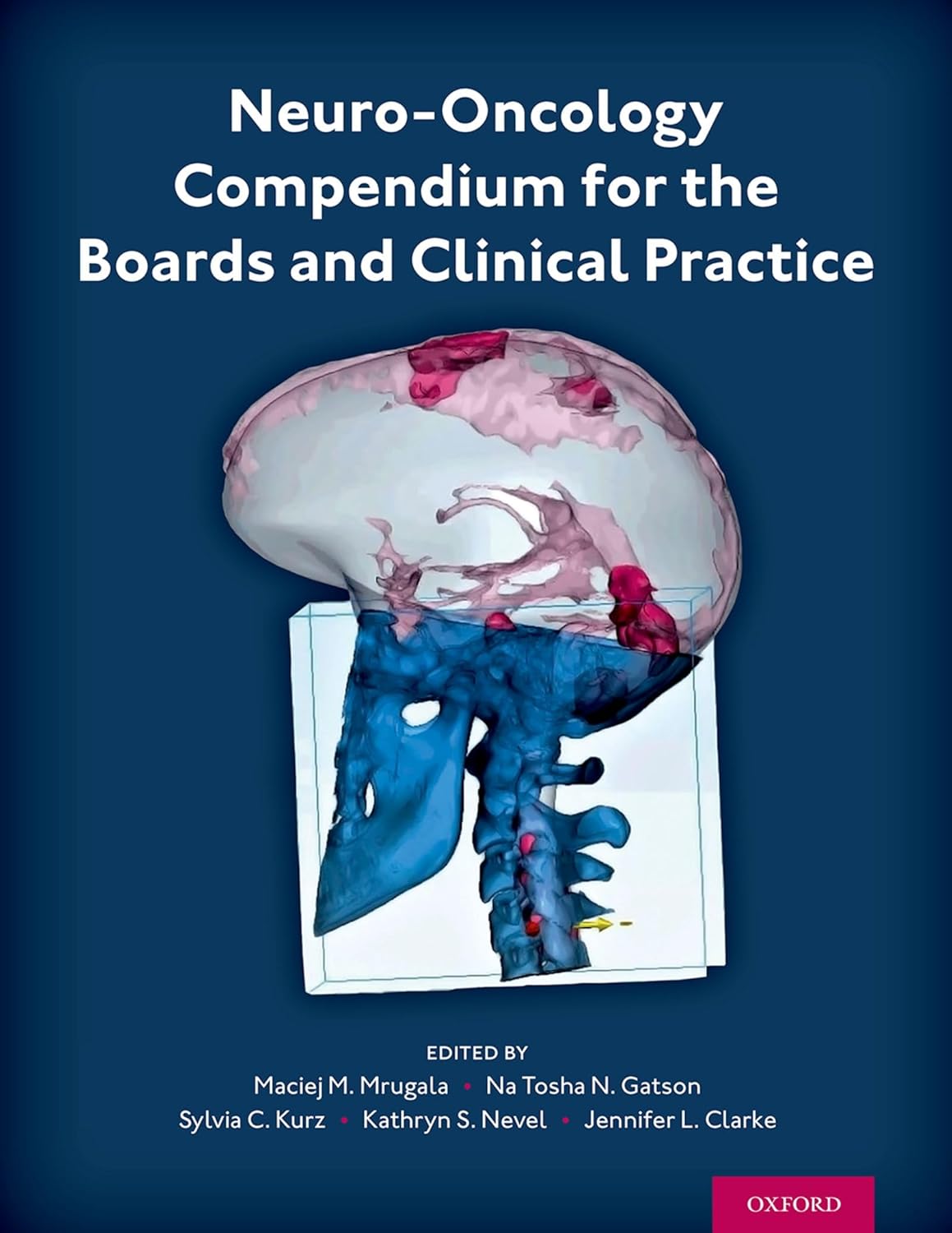 Amazon.com: Neuro-Oncology Compendium for the Boards and Clinical ...