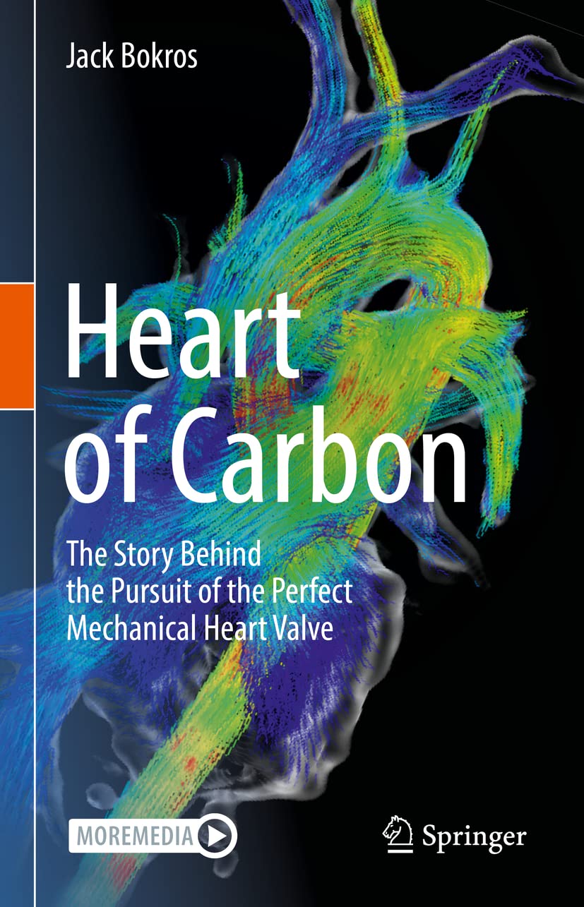 Heart of Carbon: The Story Behind the Pursuit of the Perfect Mechanical ...