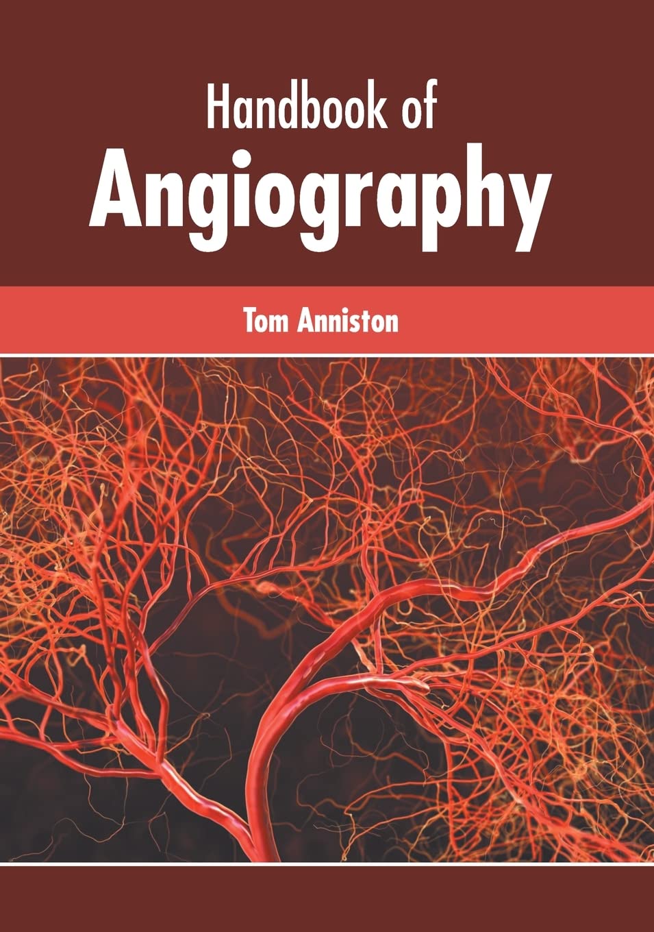Handbook of Angiography: 9781639270729: Medicine & Health Science Books ...
