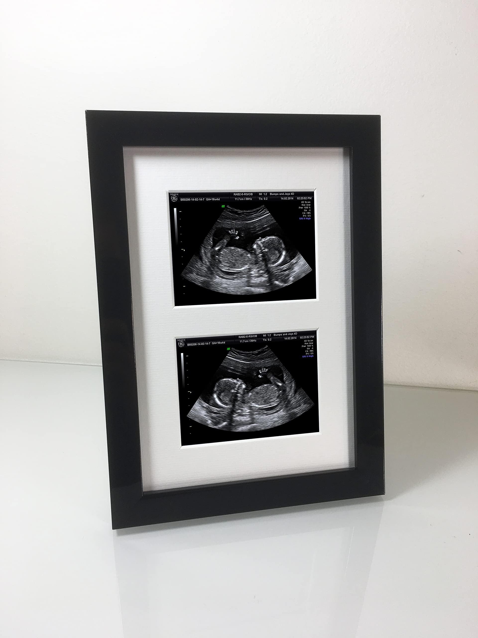 Personalised Triple Baby Scan Ultrasound White Photo Frame : Amazon.co ...