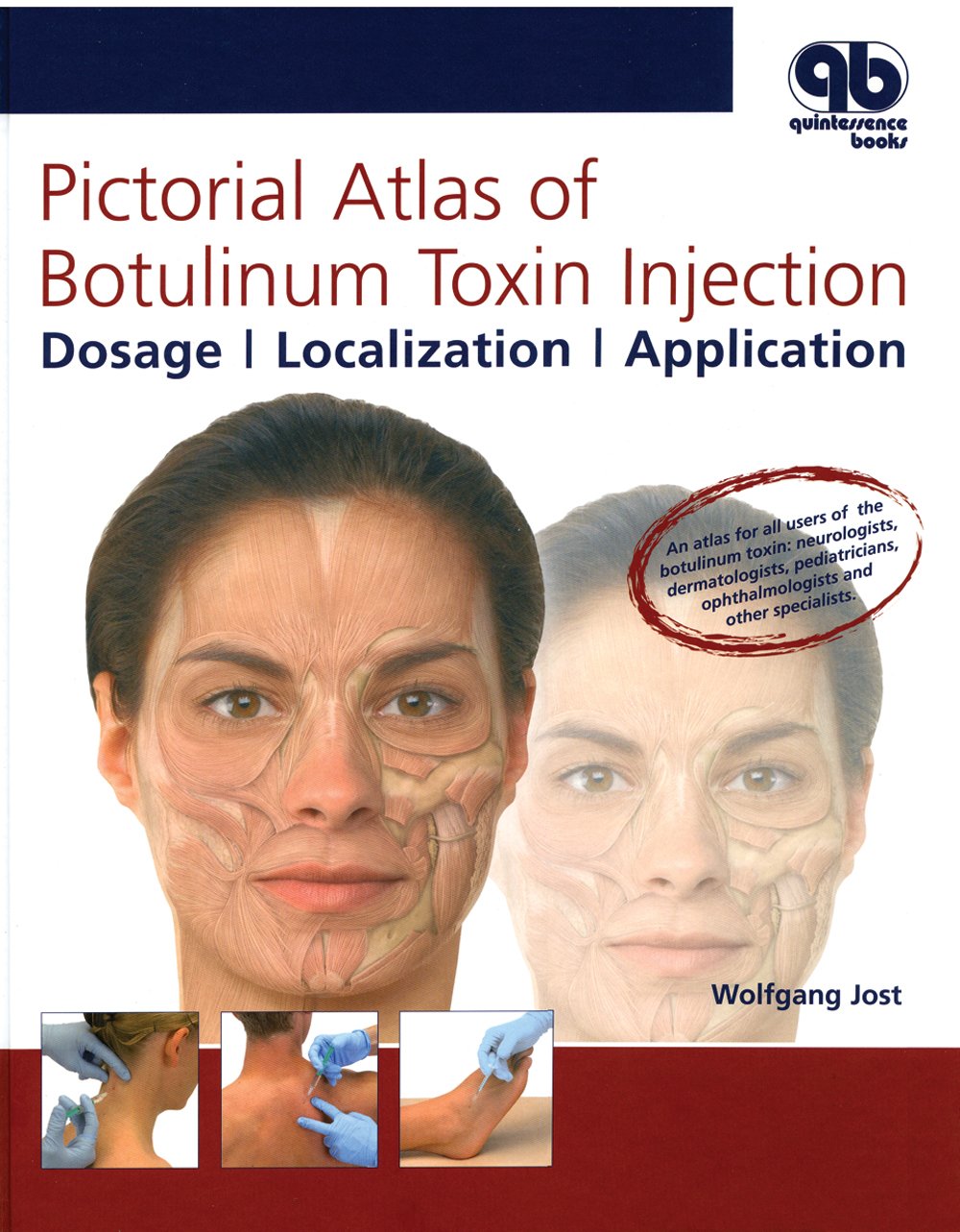 Pictorial Atlas of Botulinum Toxin Injection: Dosage, Localization ...