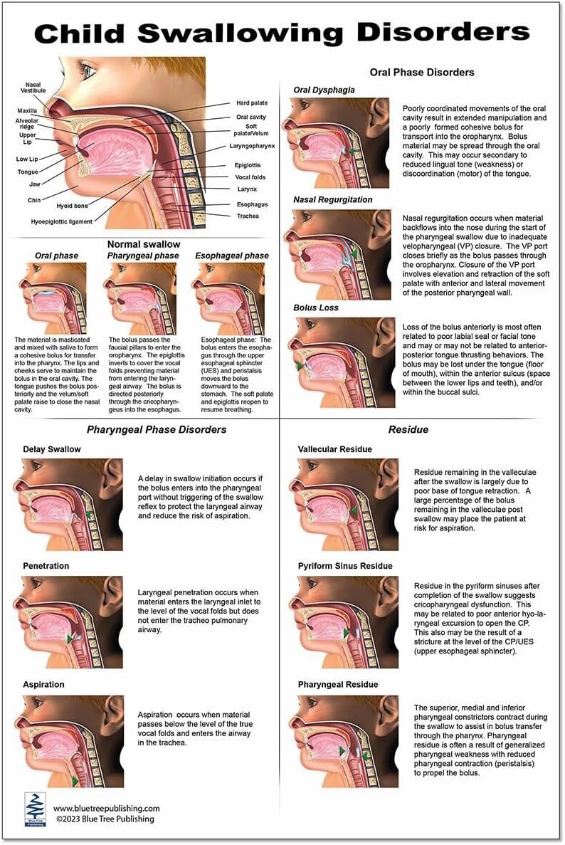 Amazon.com: Blue Tree Publishing Child Swallowing Disorders Chart ...