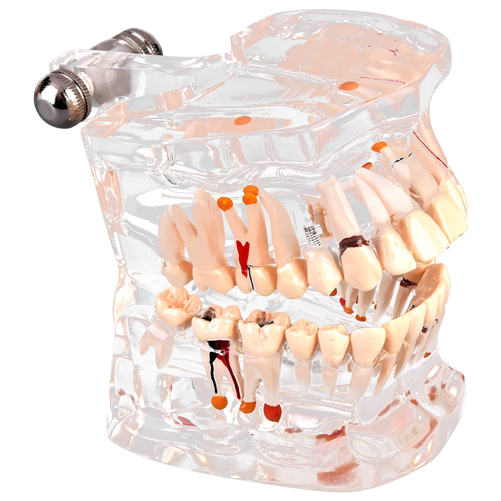 Buy Teeth Model Dental Model Mouth Model Transparent Gingival Tooth ...