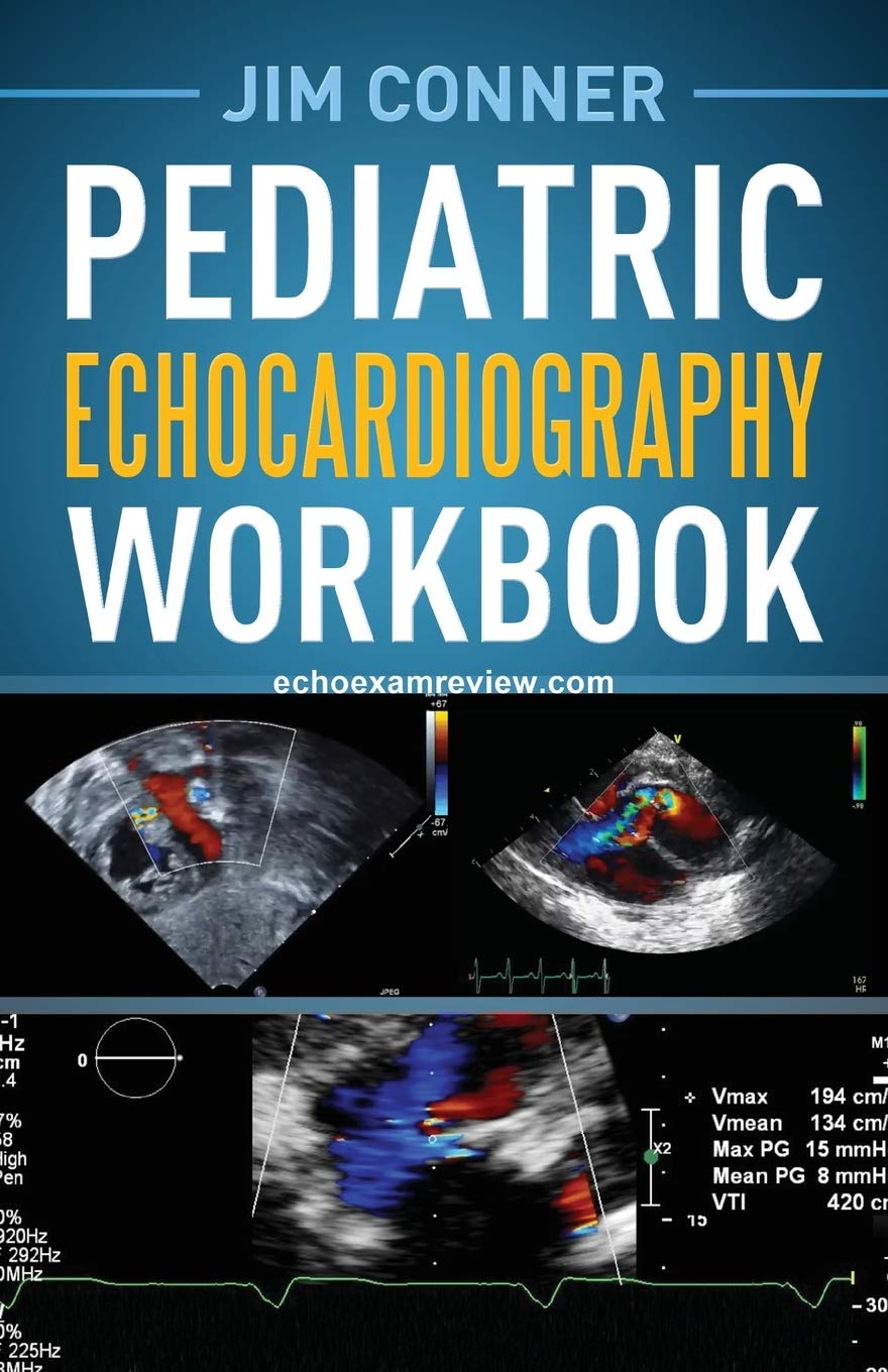 Pediatric Echocardiography Workbook: Conner, Jim: 9781642375572: Amazon ...