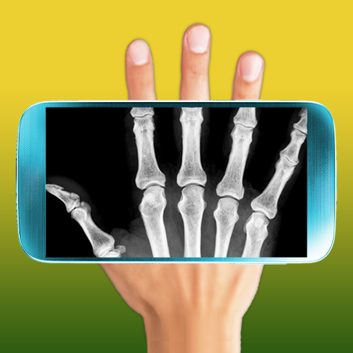 Xray Simulator Prank - App on Amazon Appstore