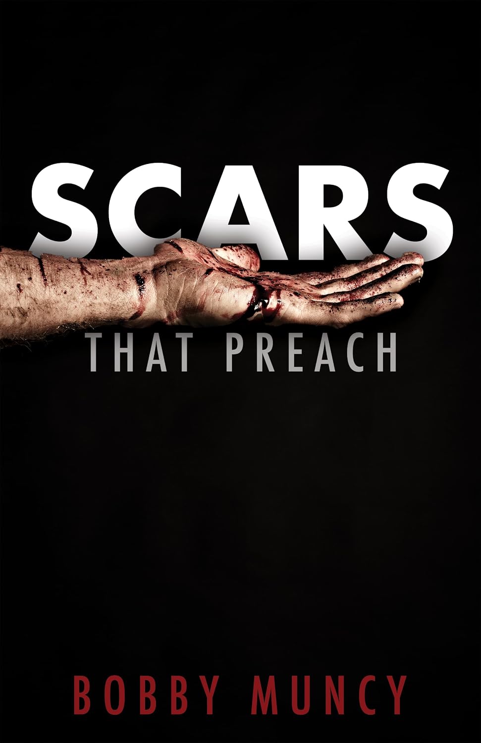 Scars that Preach eBook : Muncy, Bobby: Amazon.ca: Kindle Store