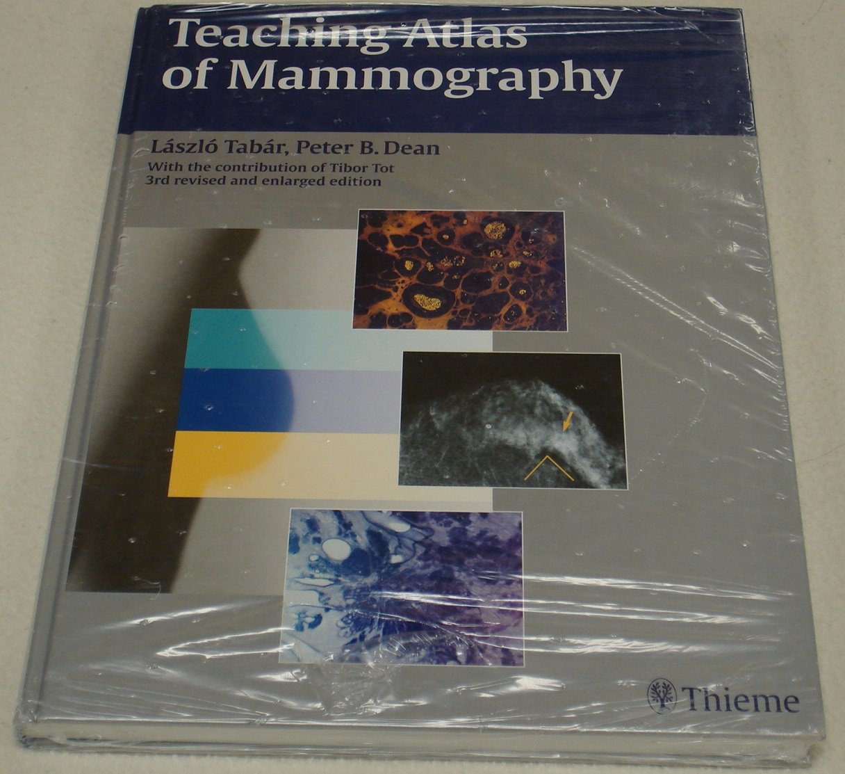 Teaching Atlas of Mammography : Tabar, Laszlo, Dean, Peter B, Tot ...