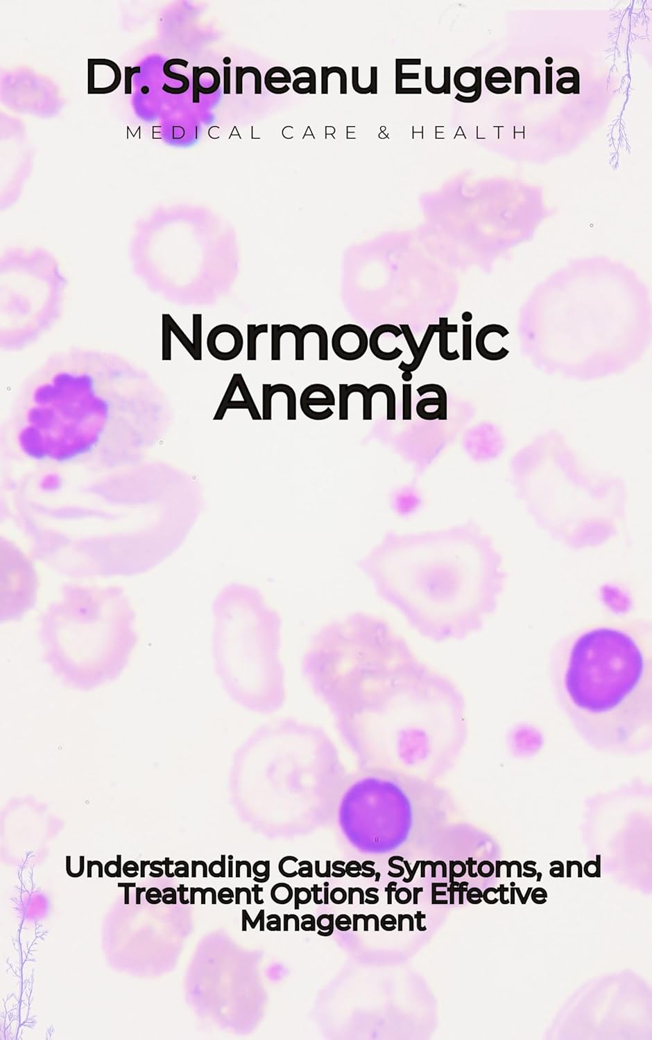 Amazon.co.jp: Normocytic Anemia: Understanding Causes, Symptoms, and ...
