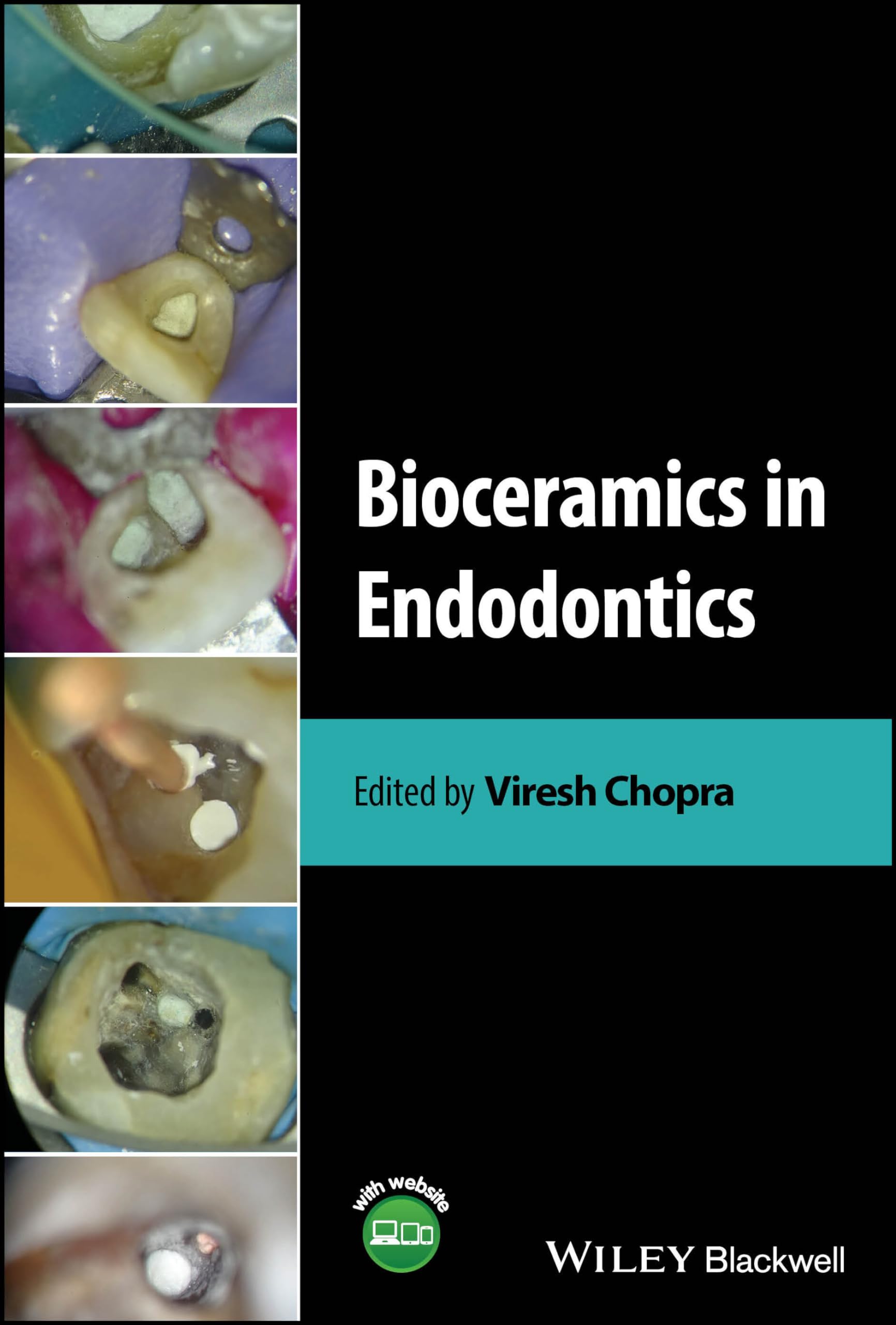 Amazon | Bioceramics in Endodontics | Chopra, Viresh | Dental Materials