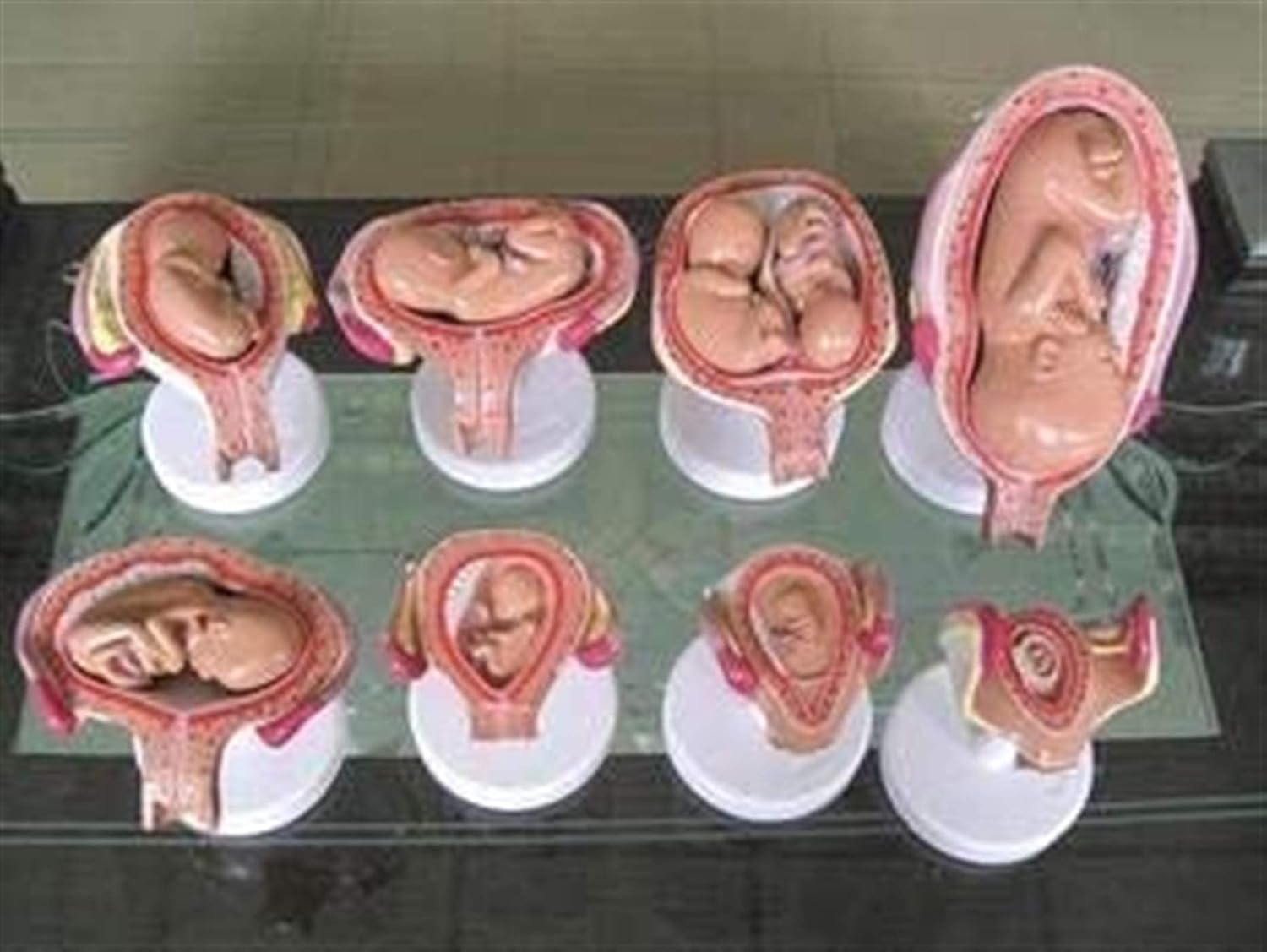 Amazon.com: Anatomical Model for Human Fetus Development Fetus ...