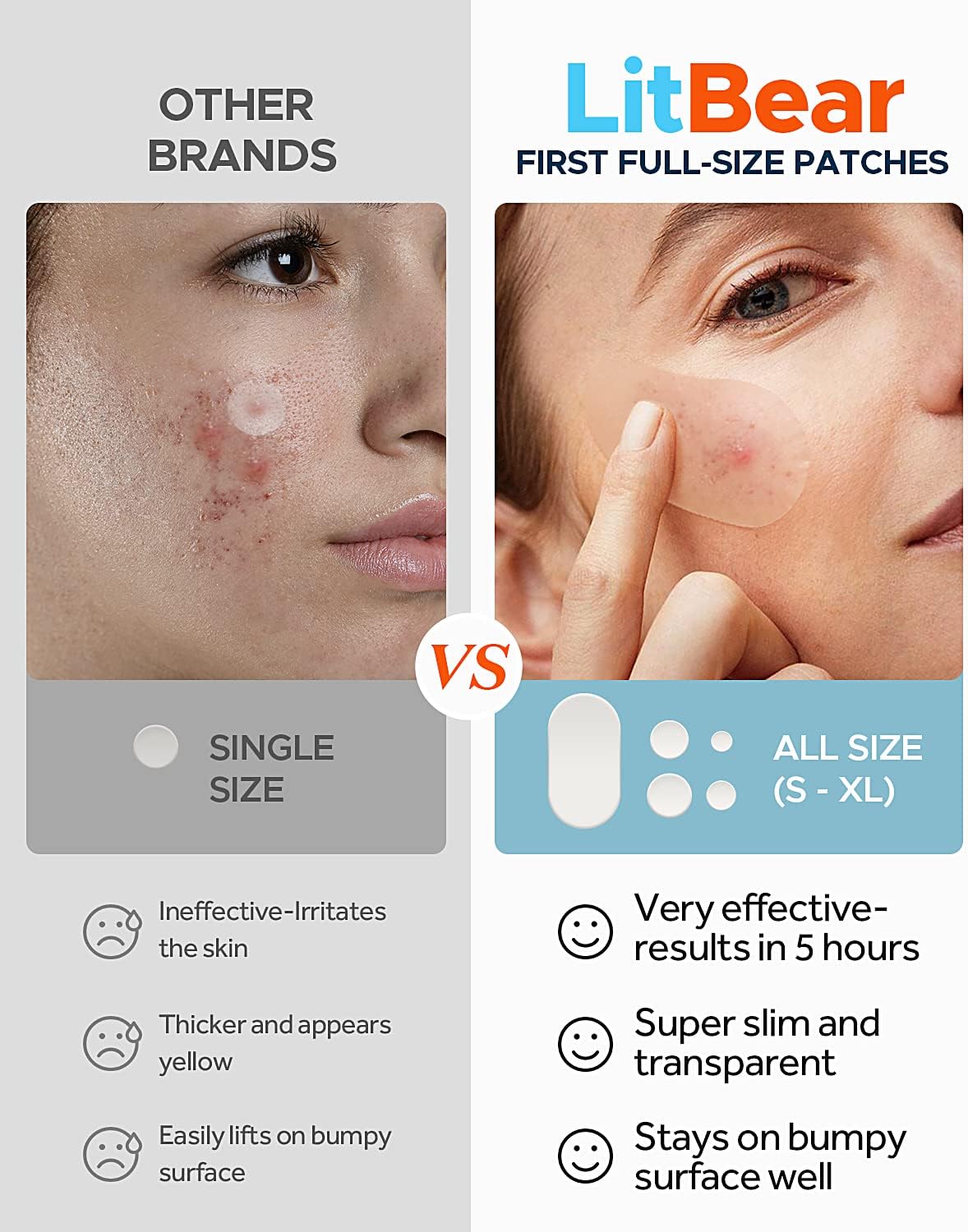 Acne Pimple Spot Patches for Large Zit Breakouts, LitBear Acne Patches ...