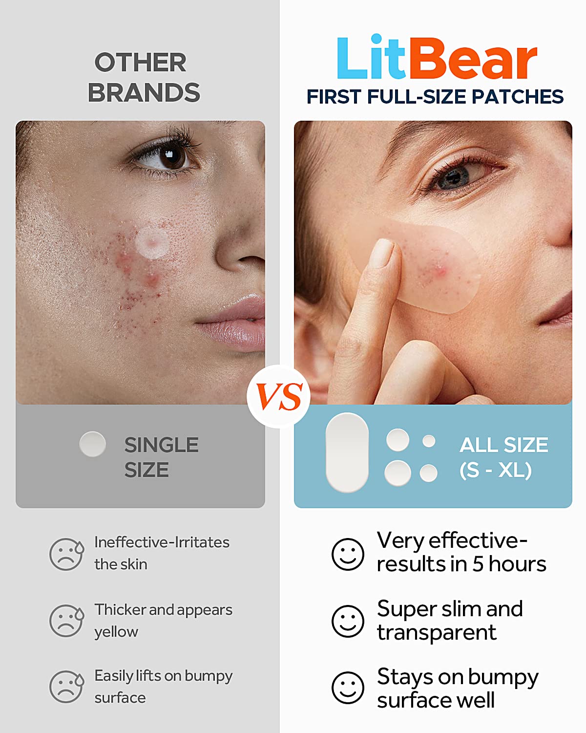 Parches para granos de acné, 5 tamaños 80 parches para...B09MT71P9B ...