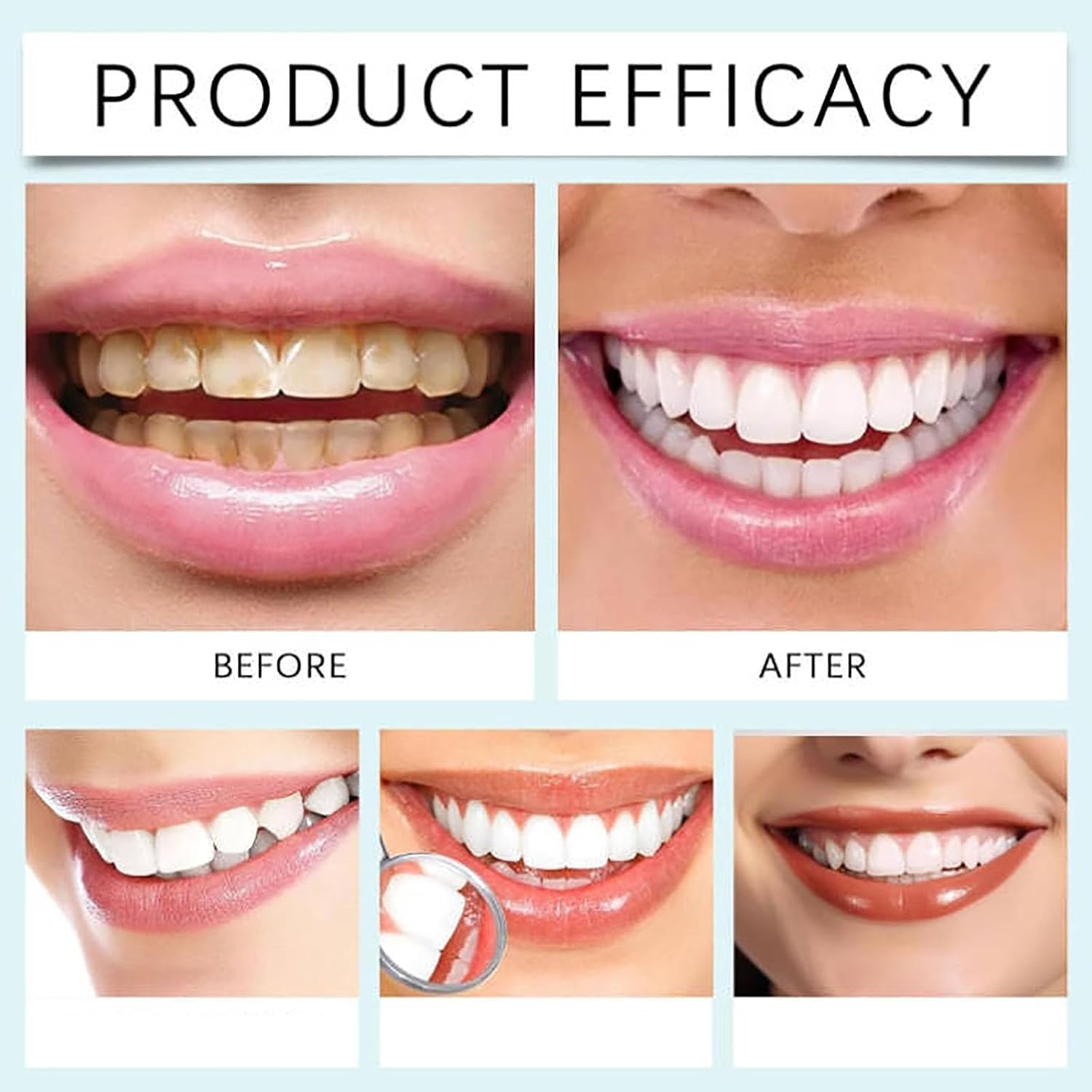 Creme Dental Radiant Whitening, Clareamento Intensivo e Cuidados ...
