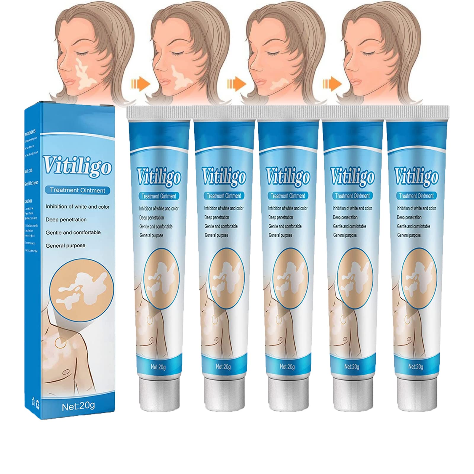 Vitiligo Treatment Cream 20g White Spot Cream Vitiligo Cream Treatment 8092