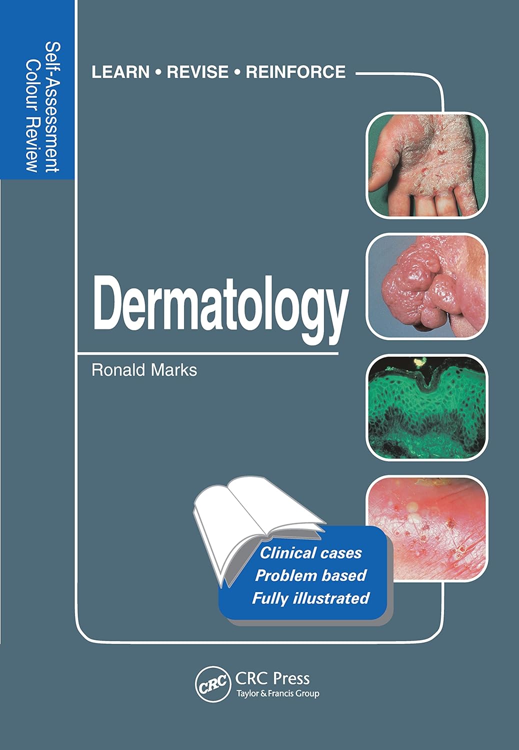 Dermatology: Self-Assessment Colour Review (Medical Self-Assessment ...