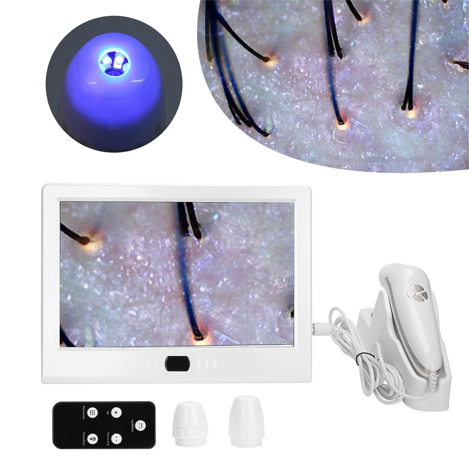 Skin Hair Analyzer, 12inch Skin Scalp Detector Nepal | Ubuy