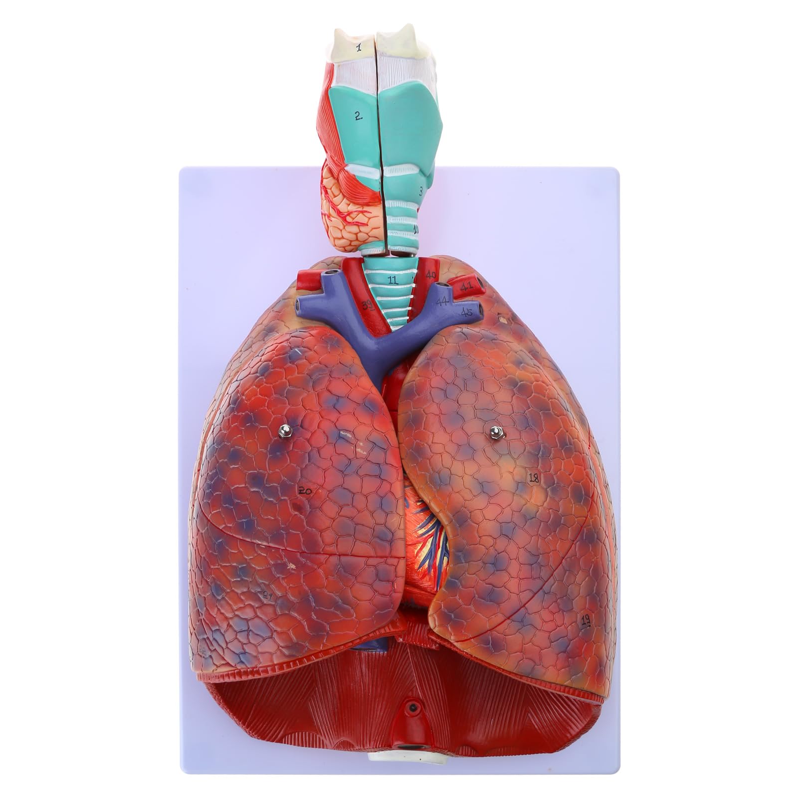 Modelo De Pulmón Tratamiento Del Cáncer De Pulmón De Células No