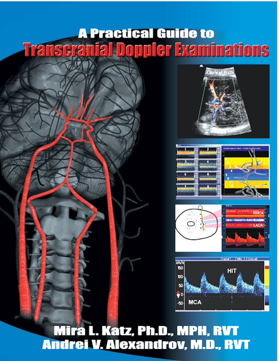 Practical Guide to Transcranial Doppler Examinations: 9780972065313 ...