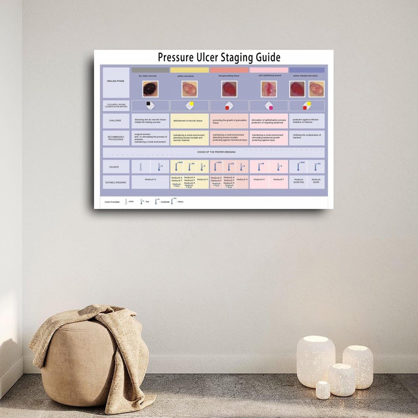 Anatomy Poster Stages Of Pressure Ulcers Chart | Bedsore Decubitus ...