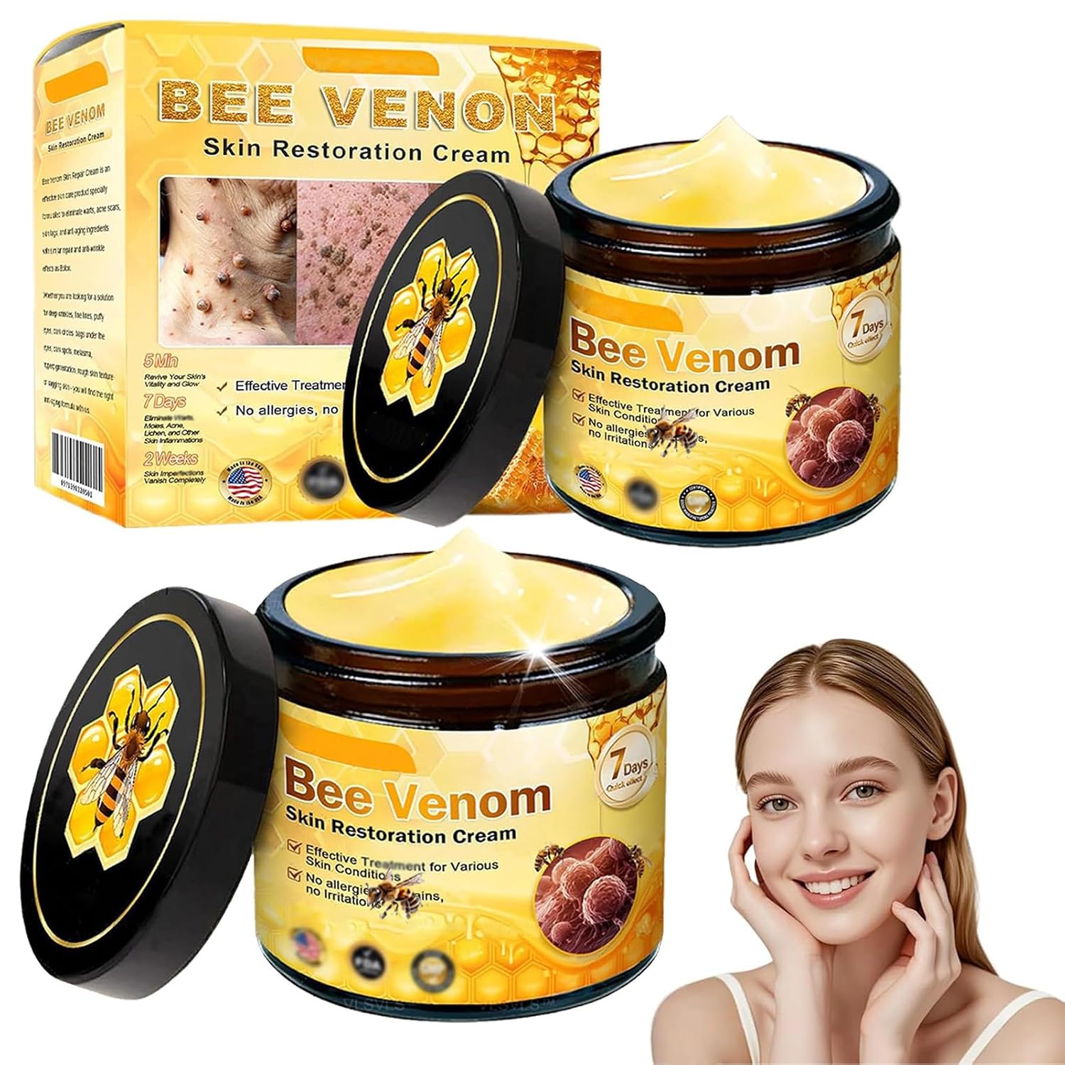 Amazon.com: 2PCS Bee Venom Skin Restoration Cream, Bee Venom Skin ...