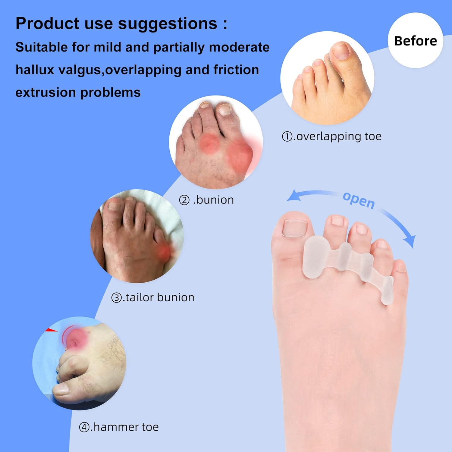 Gel Toe Separators Toe Strengthener DYKOOK 3 Pair of Toe spacers for ...