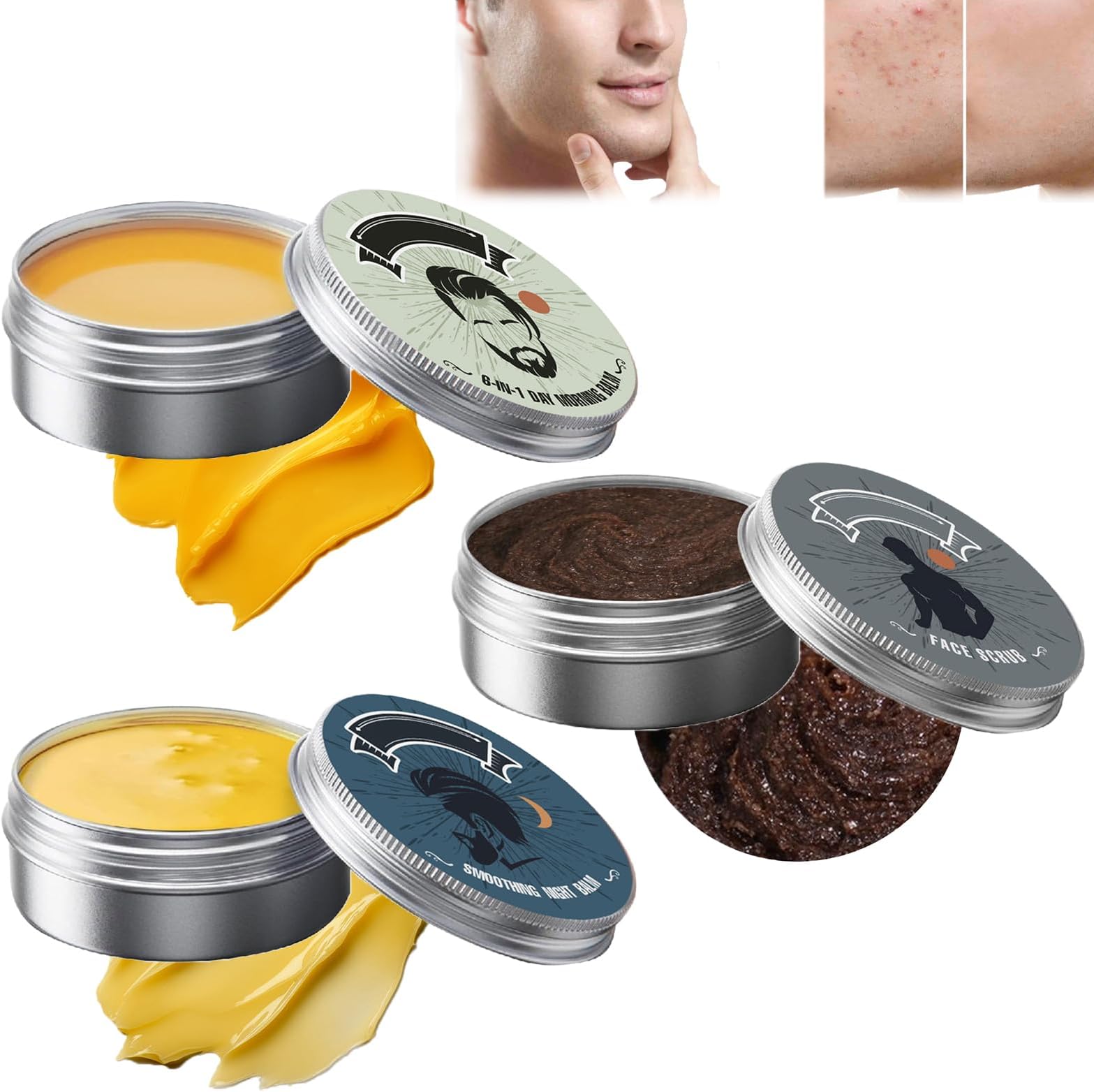 Amazon.com: 50ML-Acne Remove Skin Care Set, Acne & Redness Killer ...