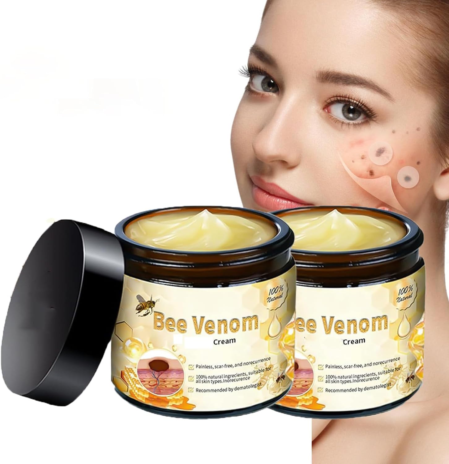 Amazon.com : Ylahdent 2 PCS Bee Venom Cream, 2024 New Professional Bee ...