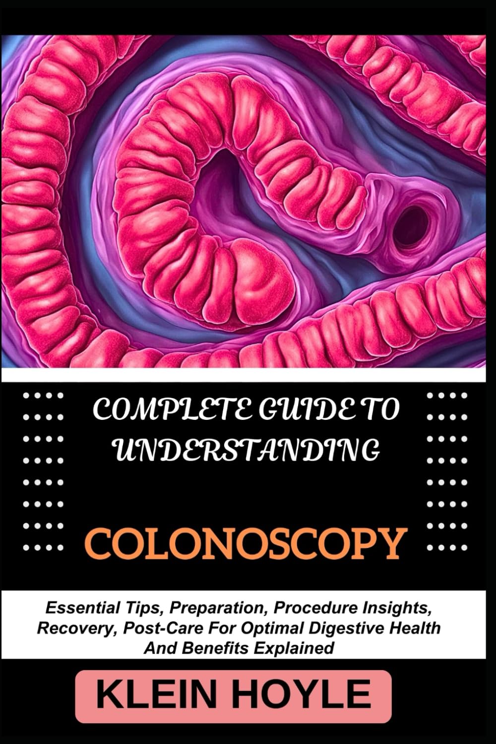 Amazon | COMPLETE GUIDE TO UNDERSTANDING COLONOSCOPY: Essential Tips ...