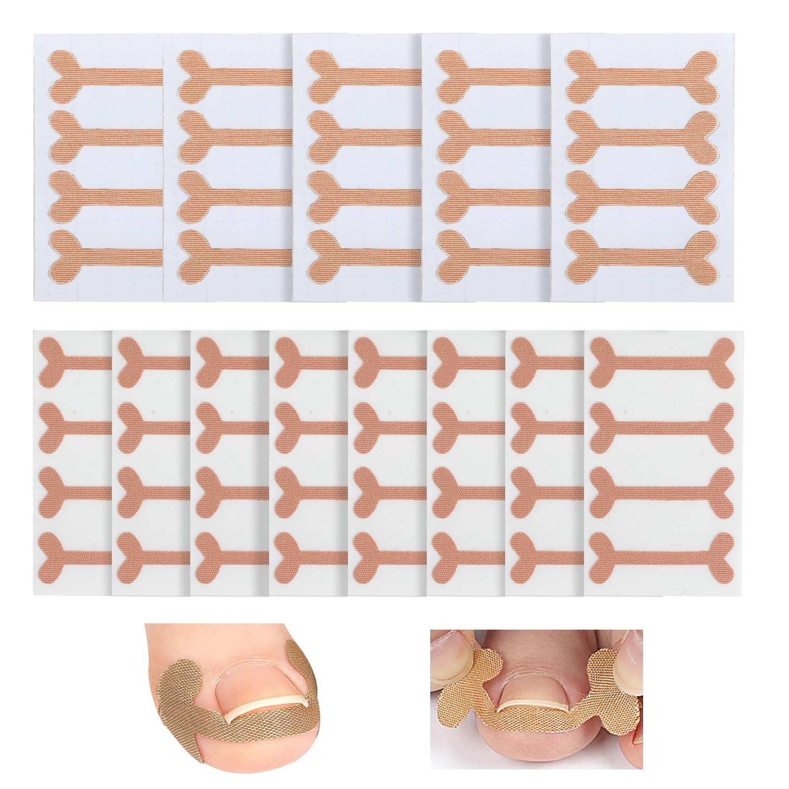 Amazon.com: 52PCS Ingrown Toenail Corrector Patches, Breathable Ingrown ...