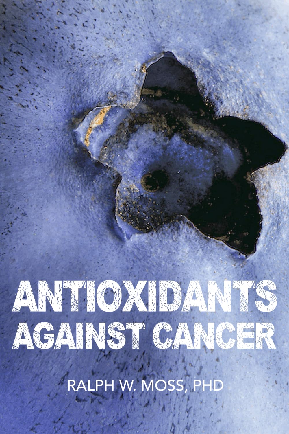 Antioxidants Against Cancer: Moss PhD, Ralph W.: 9781881025283: Amazon ...