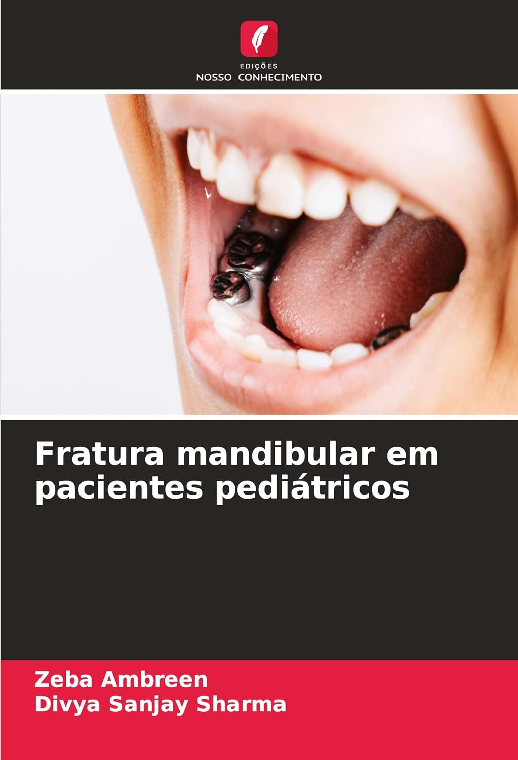 Fratura mandibular em pacientes pediátricos | Amazon.com.br