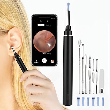 VITCOCO Ear Wax Removal, 1926P FHD Wireless Otoscope Earwax Removal ...