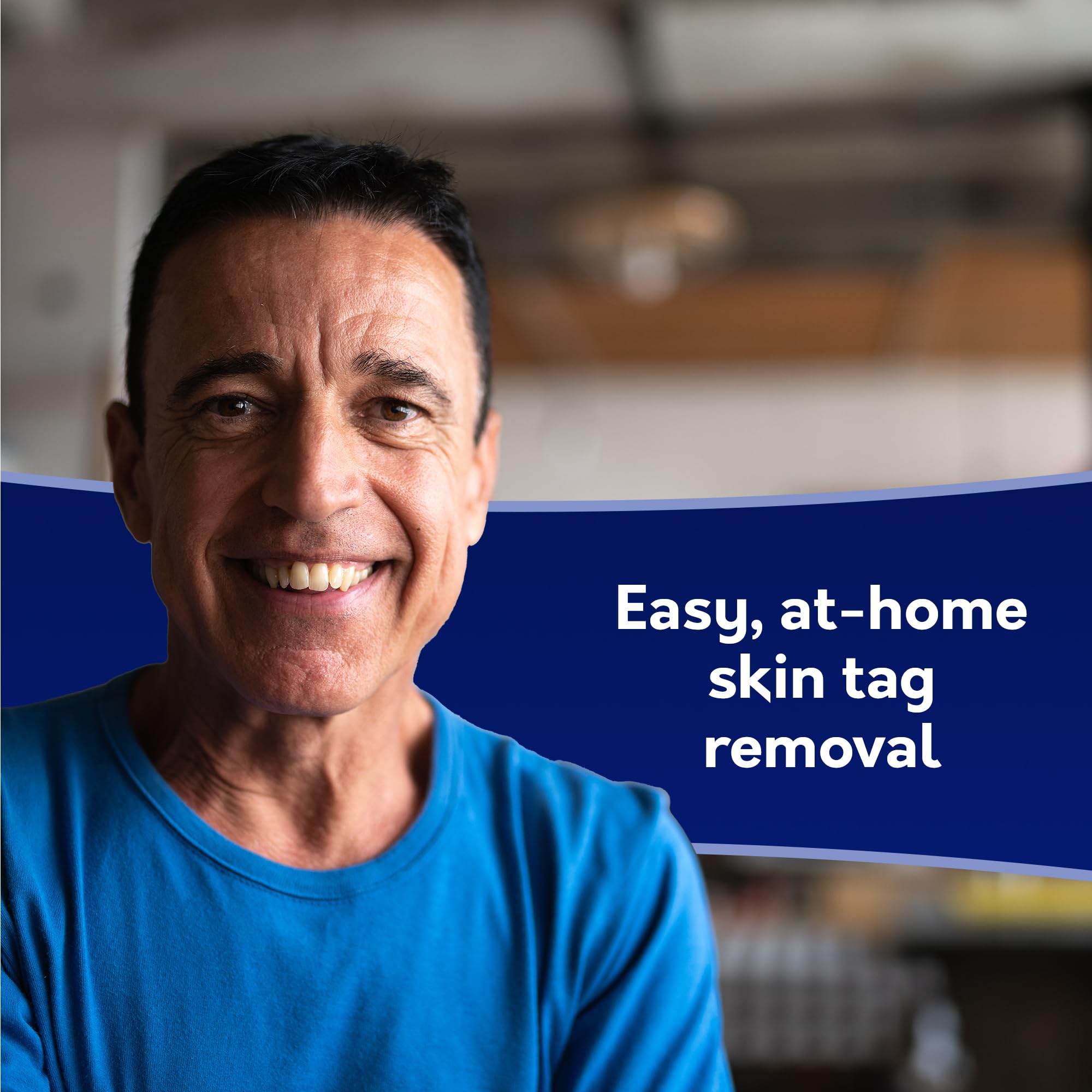 Snapklik.com : Compound W Freeze Off Skin Tag Remover, FDA Approved ...