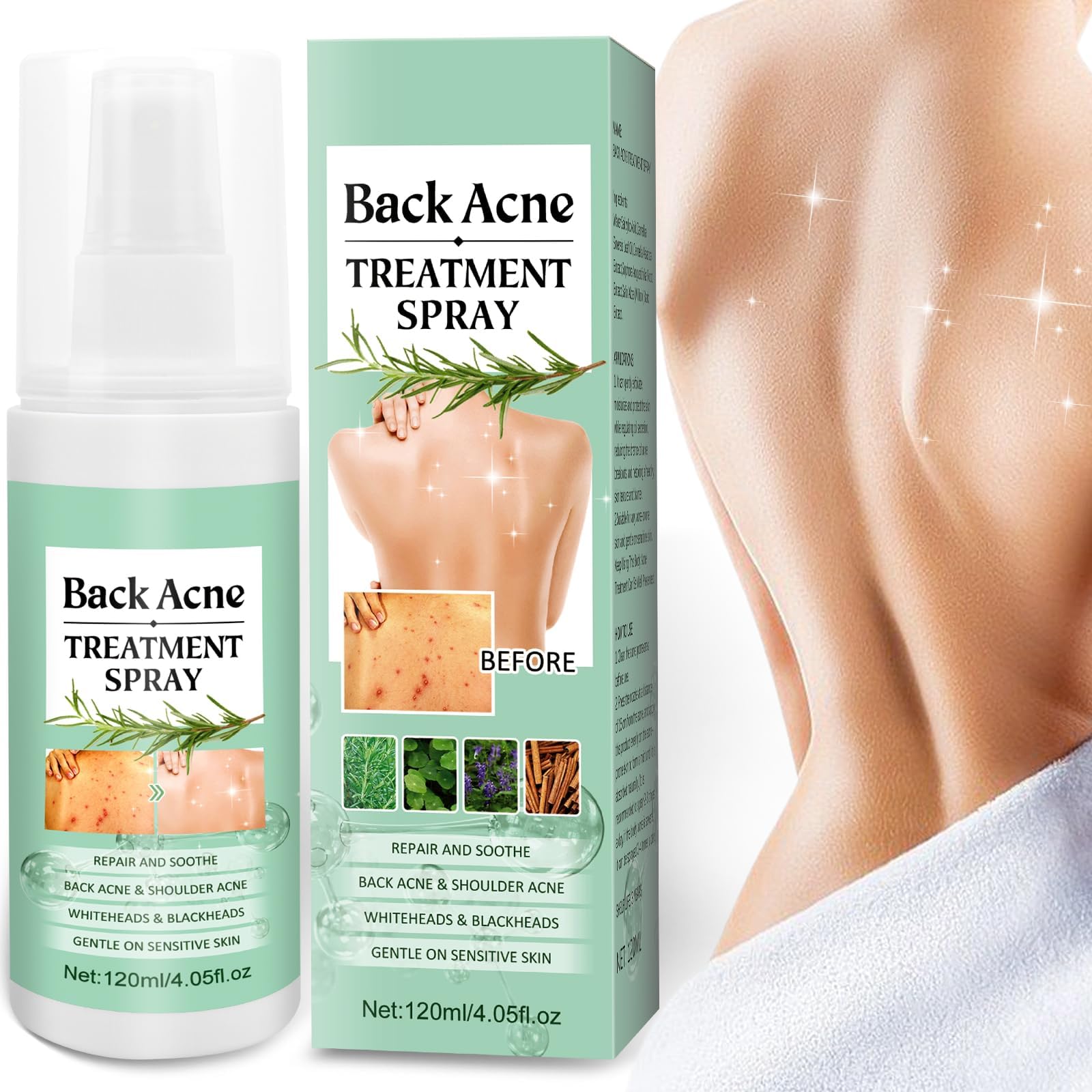 Amazon.com: Back Acne Treatment Spray - Back Acne Spray Acne Treatment ...
