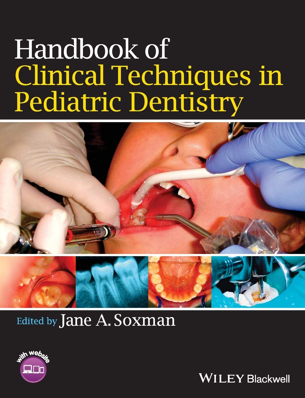 Handbook of Clinical Techniques in Pediatric Dentistry: 9781118792698 ...