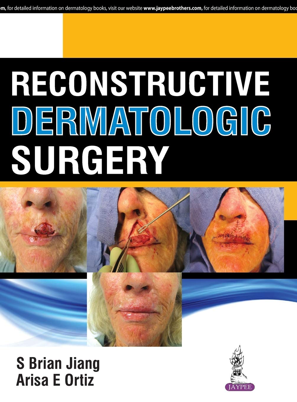 Reconstructive Dermatologic Surgery: 9789351529415: Medicine & Health ...