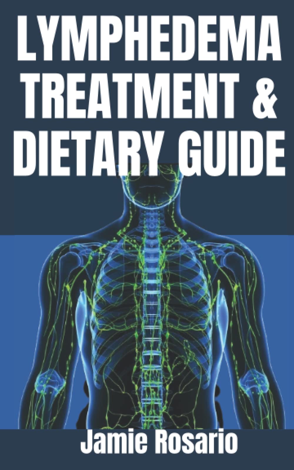 Buy LYMPHEDEMA & DIETARY GUIDE: A Beginner's Guide to Understanding ...