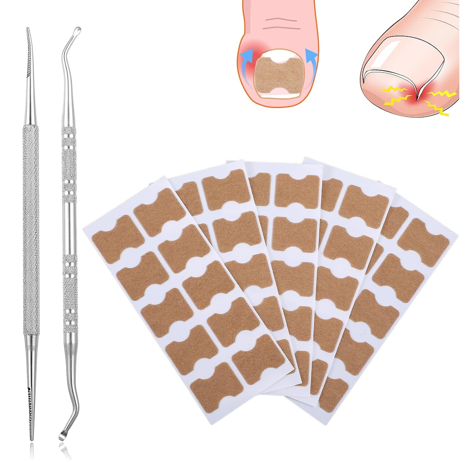 Amazon.com: Ingrown Toenail Treatment Kit, 50Pcs Breathable Toenail ...