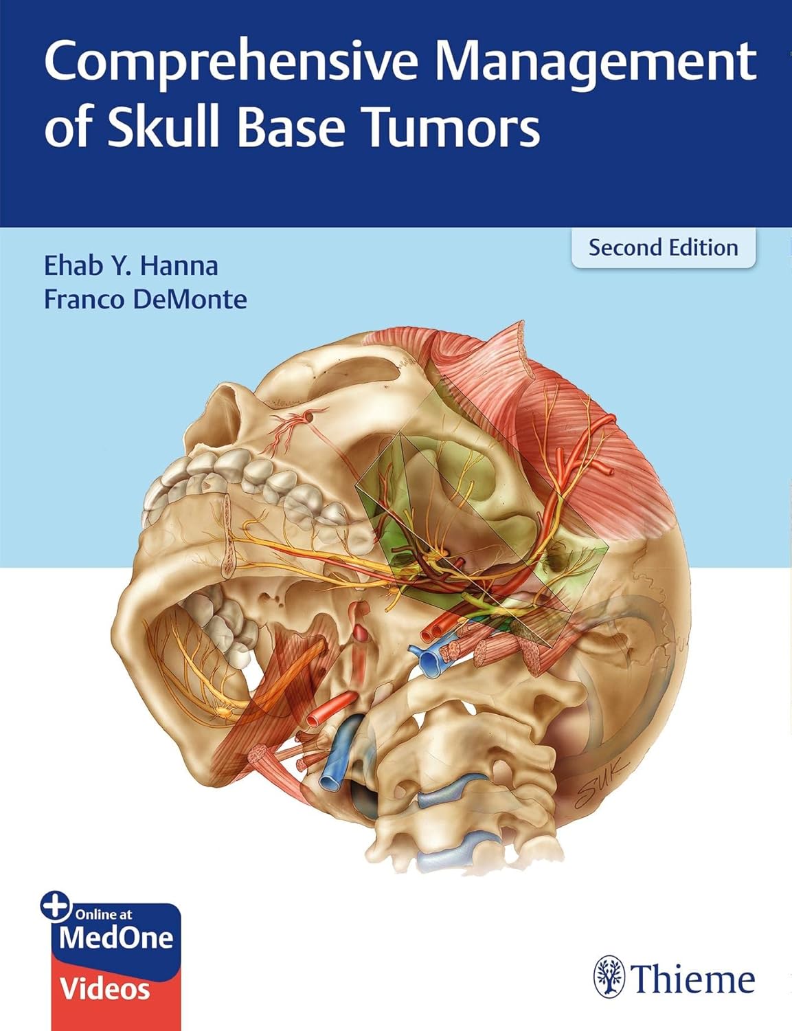 Comprehensive Management of Skull Base Tumors: 9781626235328: Medicine ...