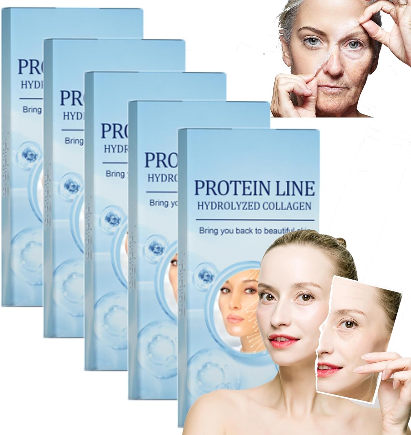 Amazon.com: Korean Soluble Protein Thread, Collagen Thread Lifting ...
