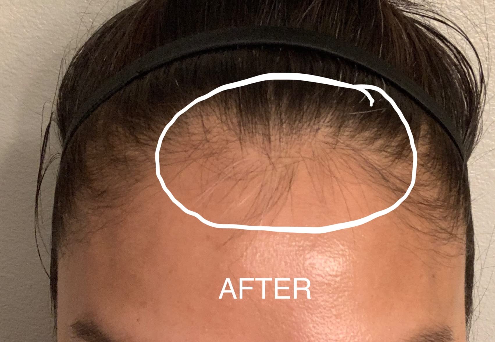 Amazon.com: BUR BUR Growing Season Hair Growth And Repair Oil | With ...