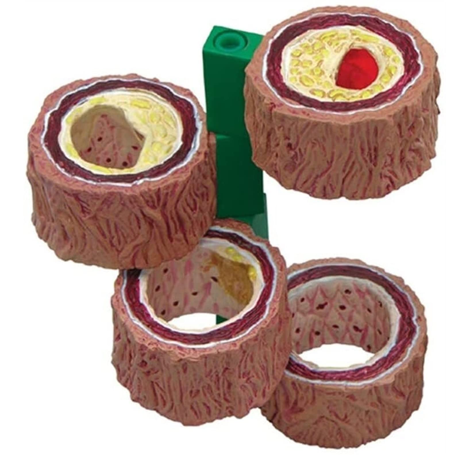 Buy Human four-segmented blood vessel model, Blood Vessel Anatomical ...