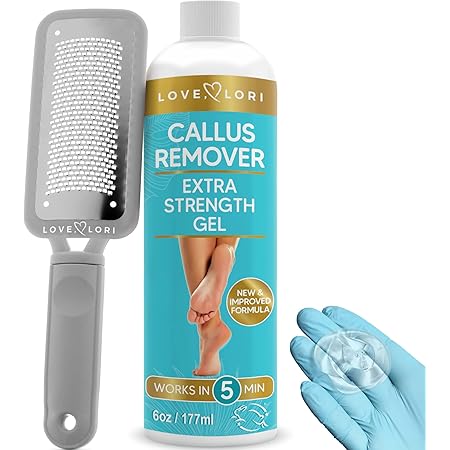 Amazon.com : Love Lori Callus Remover for Feet - Foot Spa Kit with ...