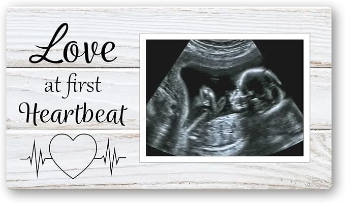 Amazon.com: Love at First Heartbeat Ultrasound Picture Frames Fridge ...