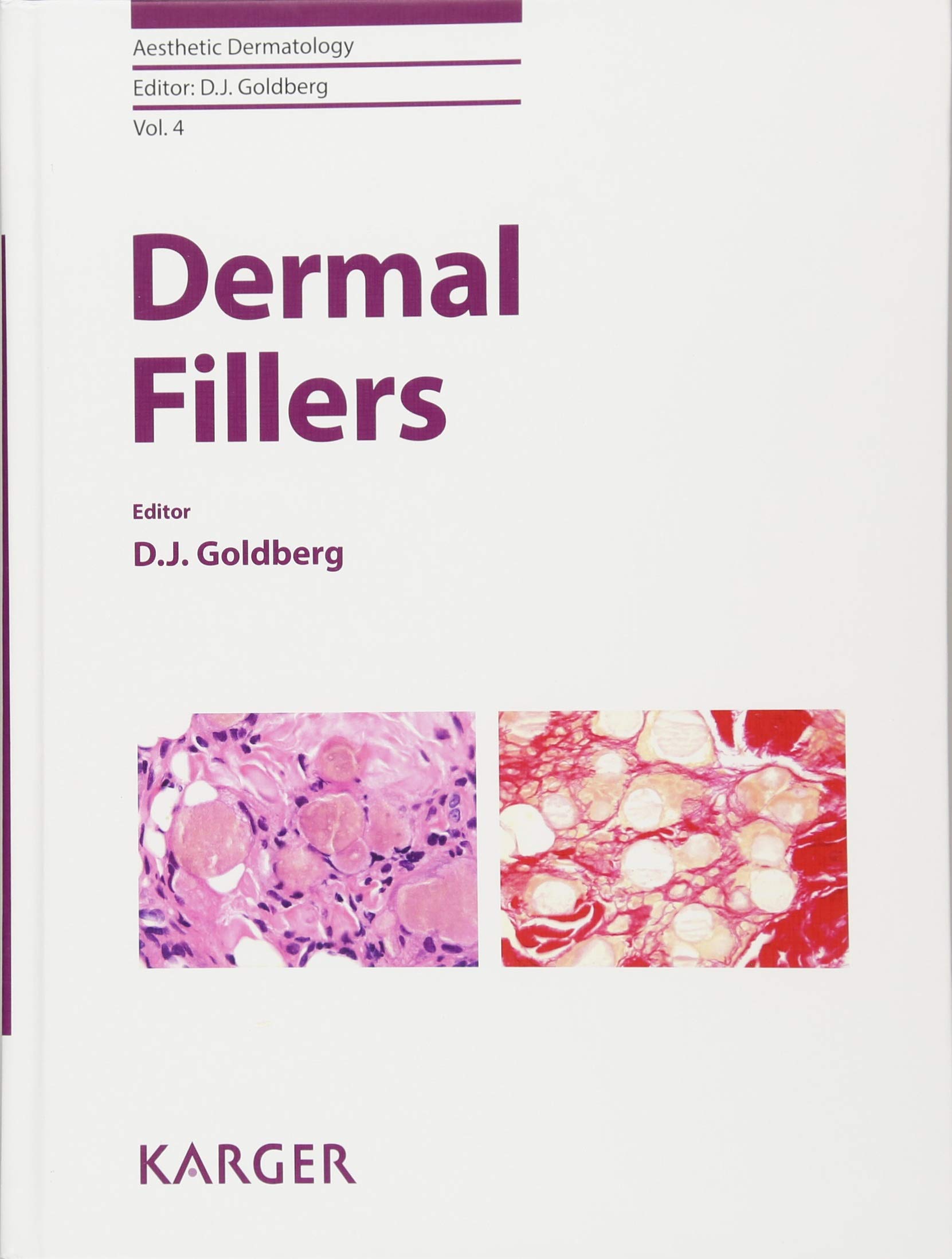 Dermal Fillers (Aesthetic Dermatology): 9783318061246: Medicine ...